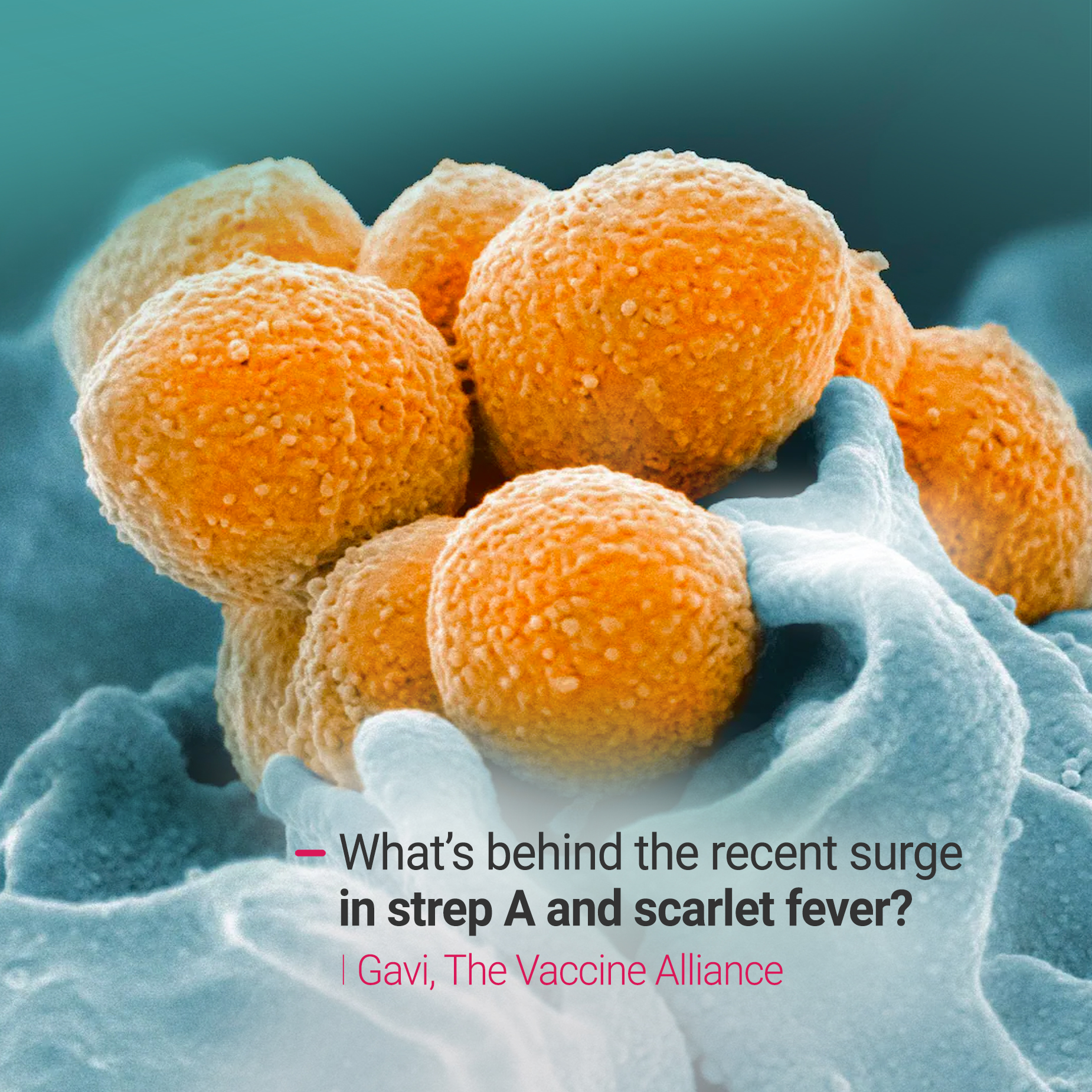 What’s behind the recent surge in strep A and scarlet fever?